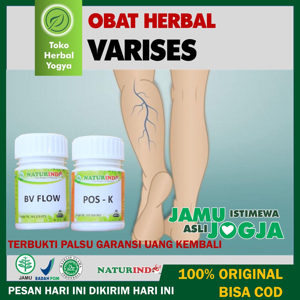 Jual Obat Varises Parises Farises Varises Kaki Betis Melancarkan ...