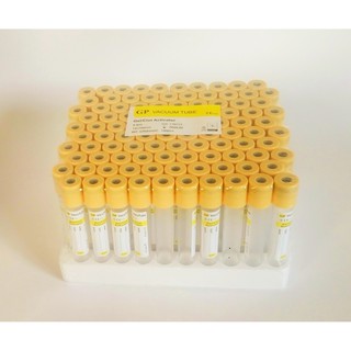 Jual Tabung Darah Vacutainer Vacum Tube Gel Clot Activator SST 8,5ml ...