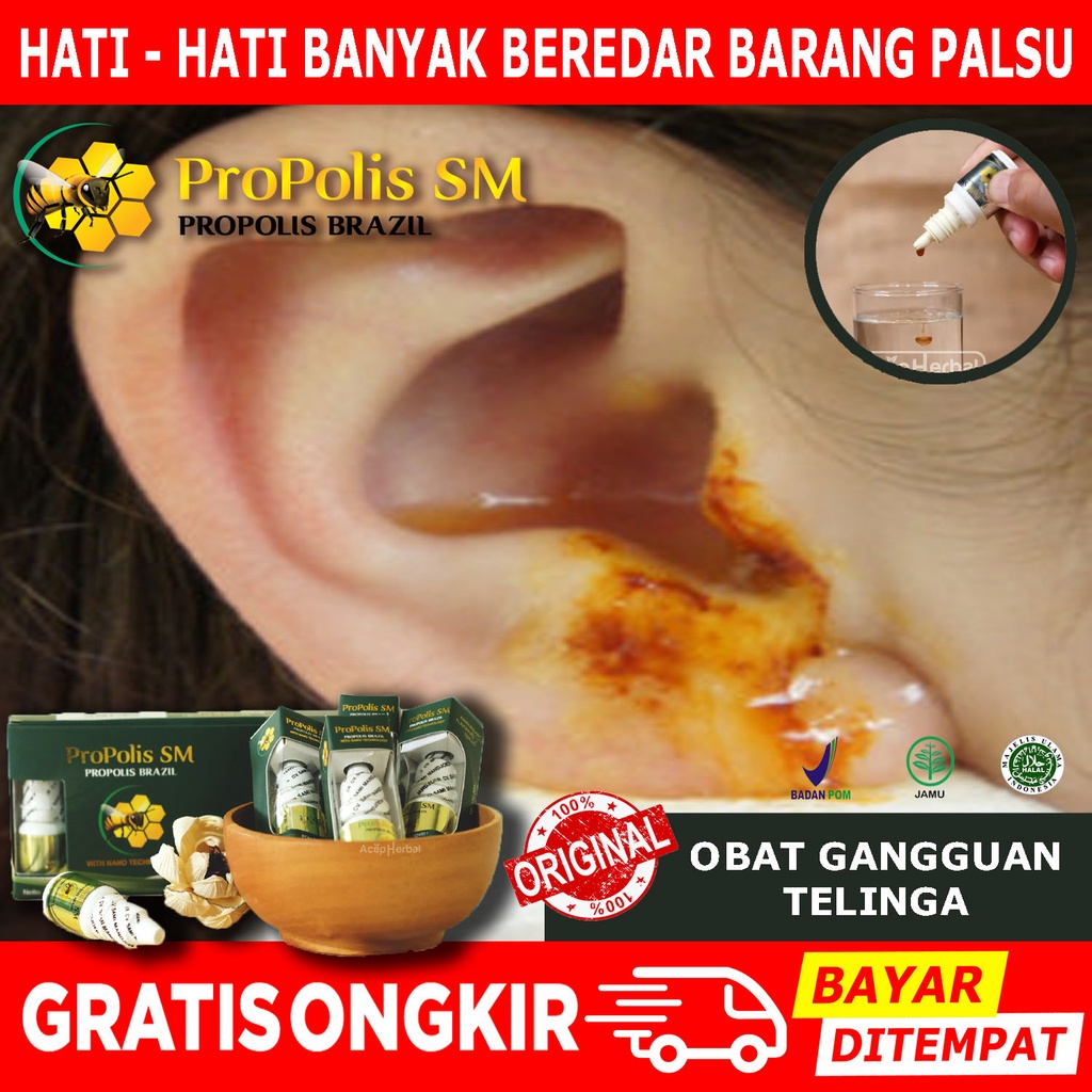 Obat Kuping Berair - Perumperindo.co.id