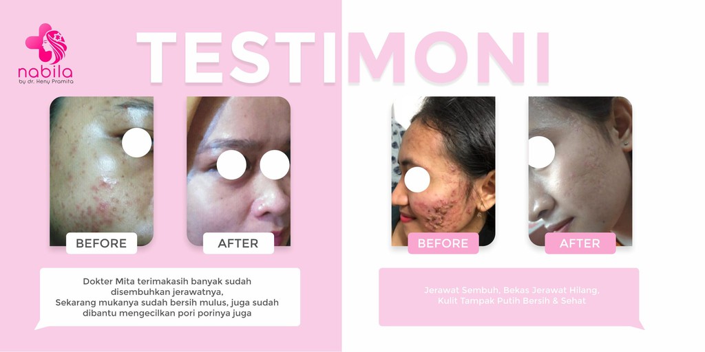 Produk NABILA SKINCARE OFFICIAL | Shopee Indonesia
