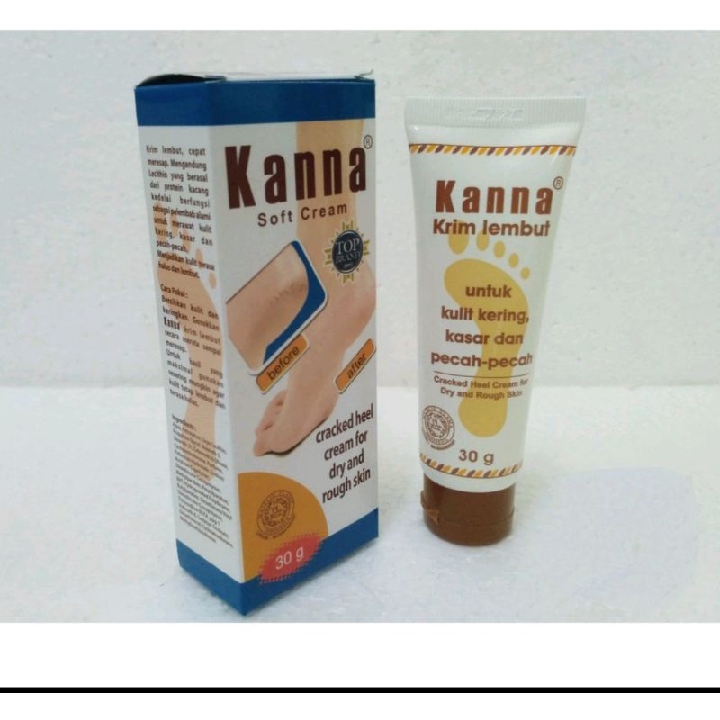 Jual KANNA Soft Cream 30 gr | Shopee Indonesia