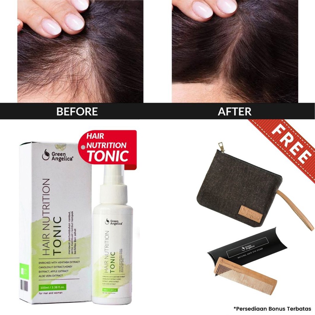 Jual Hair Nutrition Tonic Green Angelica Penyubur Rambut Botak Parah Licin Terbaik Anti Rontok ...