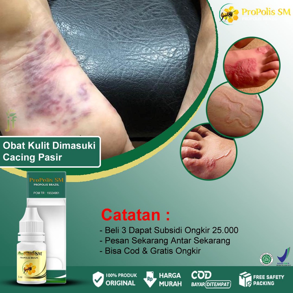 Jual Obat Khusus Cacing Larva Cacing Merayap Di Kulit Pasir Cacing ...