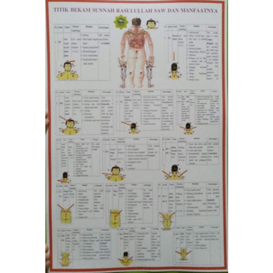 Jual poster titik bekam penyakit ringan dan kronis | Shopee Indonesia