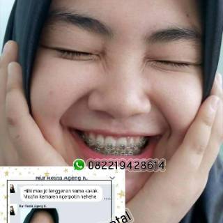 Jual PAKET BEHEL PERMANEN METAL ORTHO BRACKET ORTHO CLASSIC USA ROTH ...