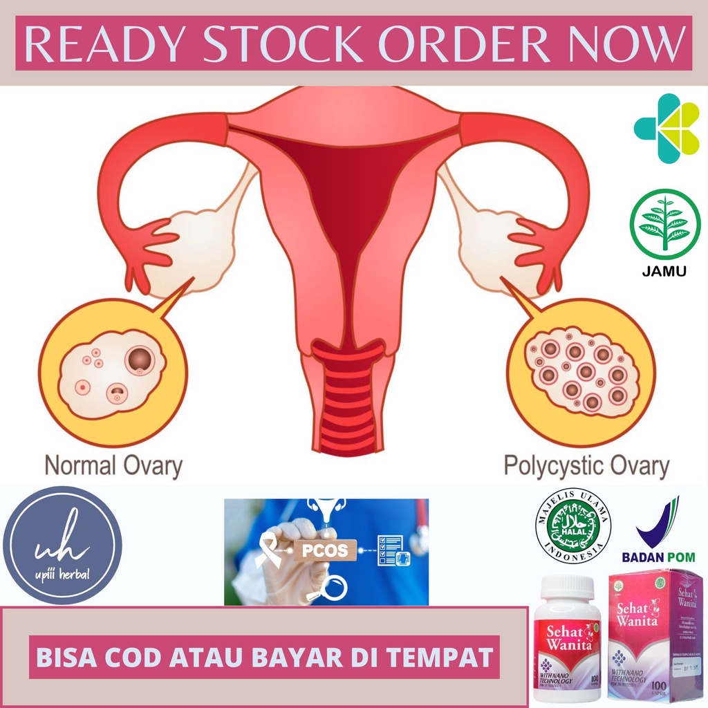 Jual Obat Pcos, Obat Untuk Pcos, Obat Sindrom Ovarium Polikistik, Obat ...