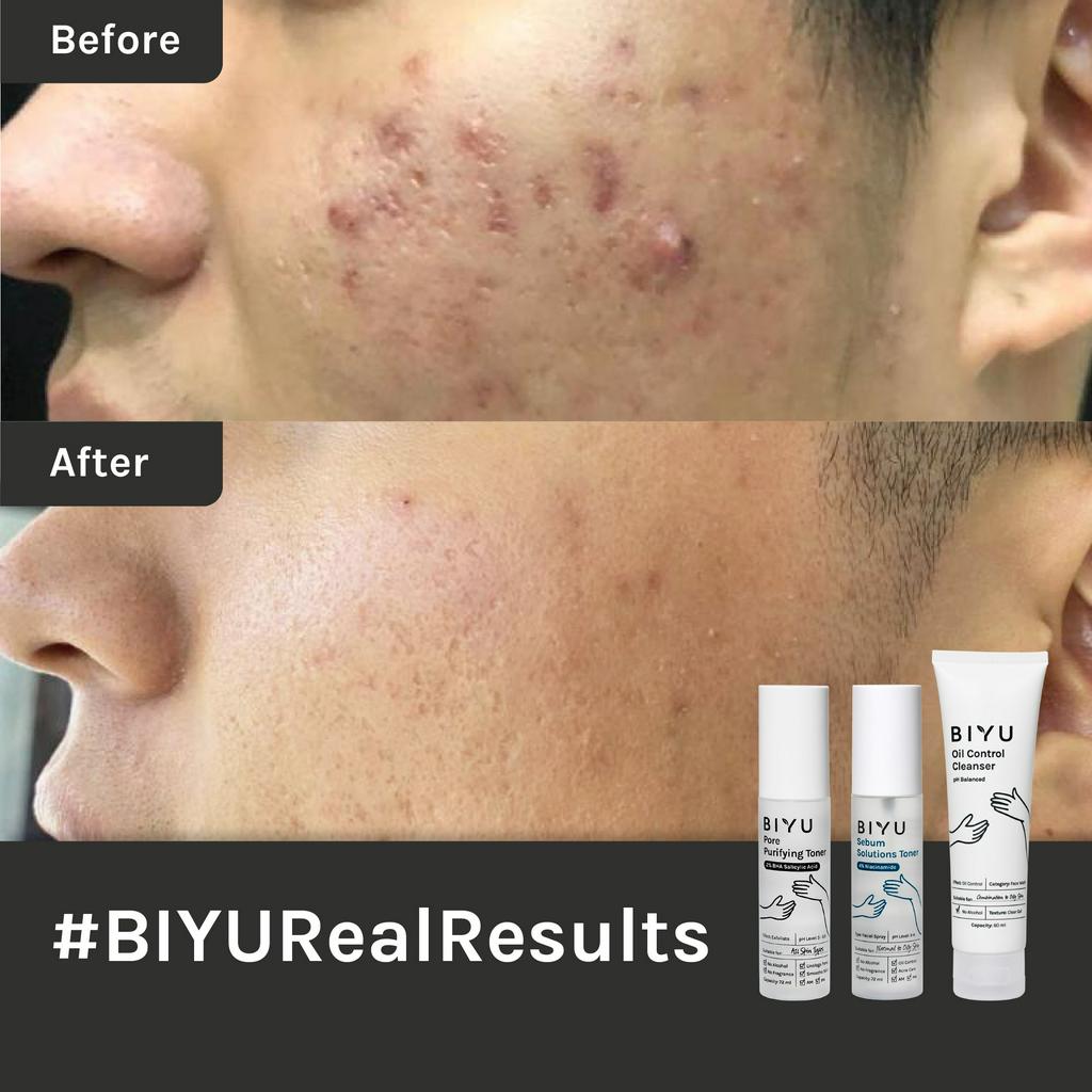 Toko Online BIYU Official Shop | Shopee Indonesia