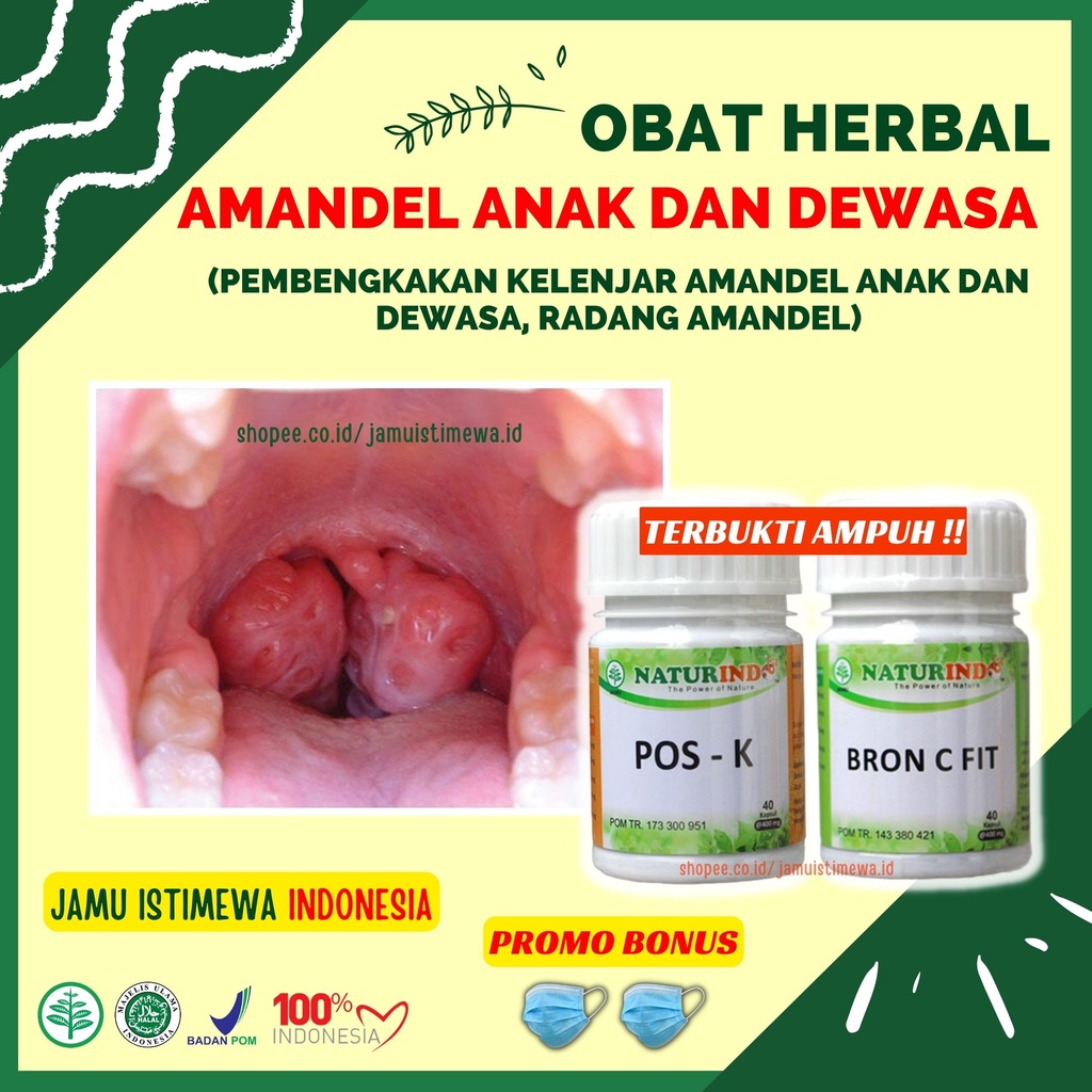 Jual Obat Amandel Paling Ampuh untuk Anak dan Dewasa Herbal Obat Bengkak Amandel Radang ...