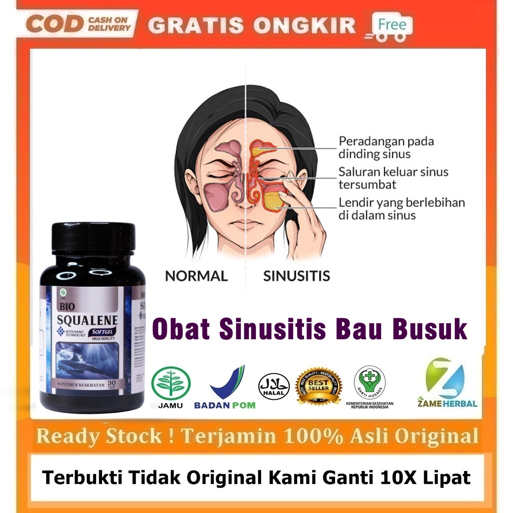 Jual Obat Sinusitis Bau Busuk | Penghilang Ingus Berbau Tidak Sedap ...