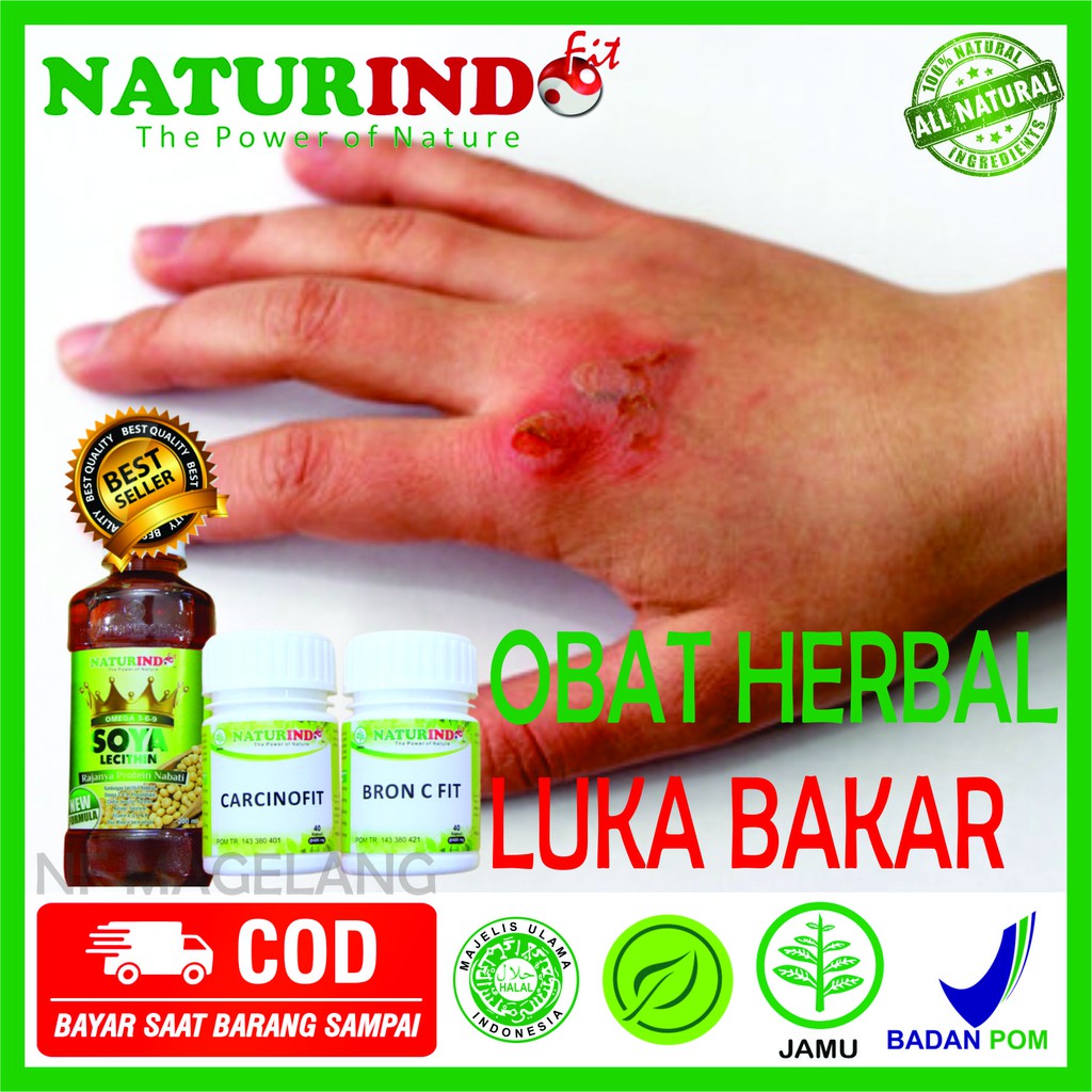 Jual OBAT bercak merah pada kulit bercak bercak merah kulit gatal ...