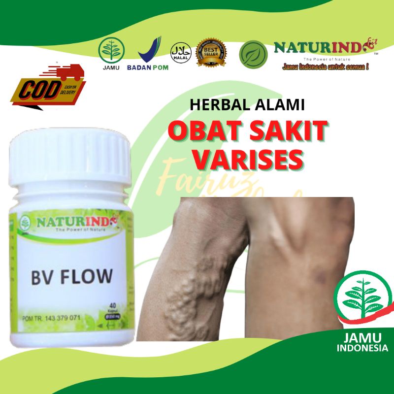 Jual Obat Sakit Varises | Shopee Indonesia
