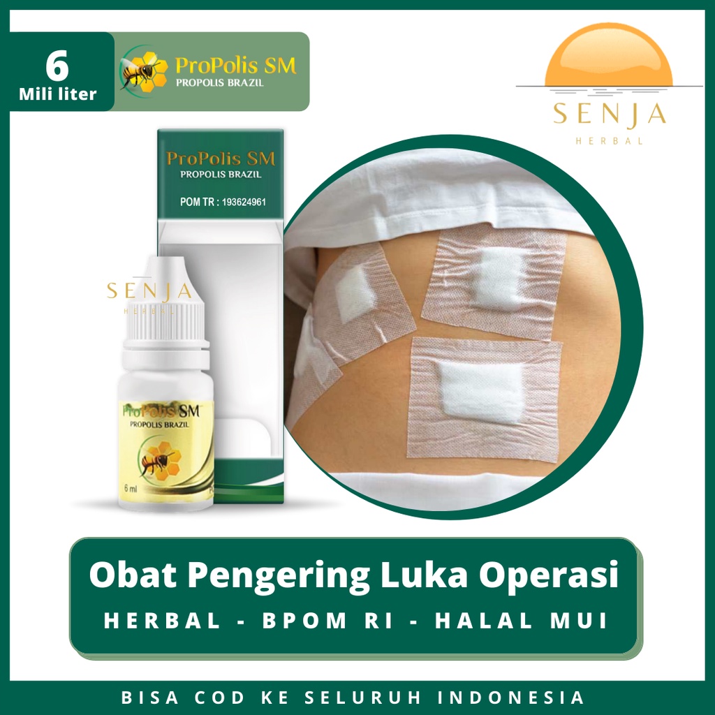 Jual Obat Pengering Luka Bekas Operasi, Caesar, Luka Bernanah ...