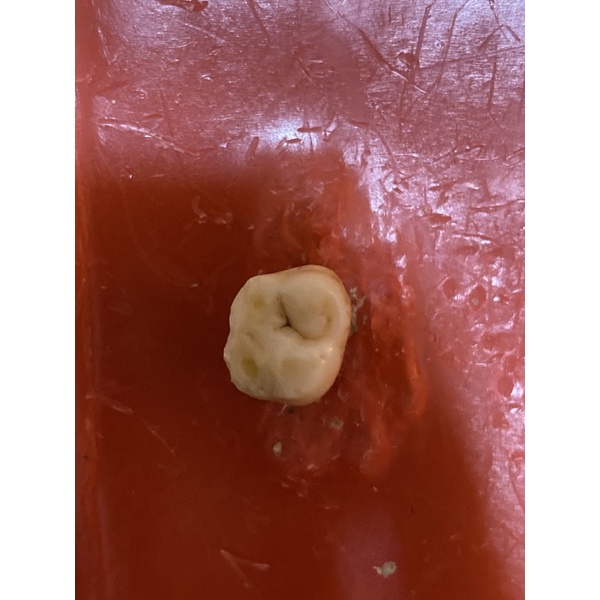 Jual gigi molar atas kanan | Shopee Indonesia