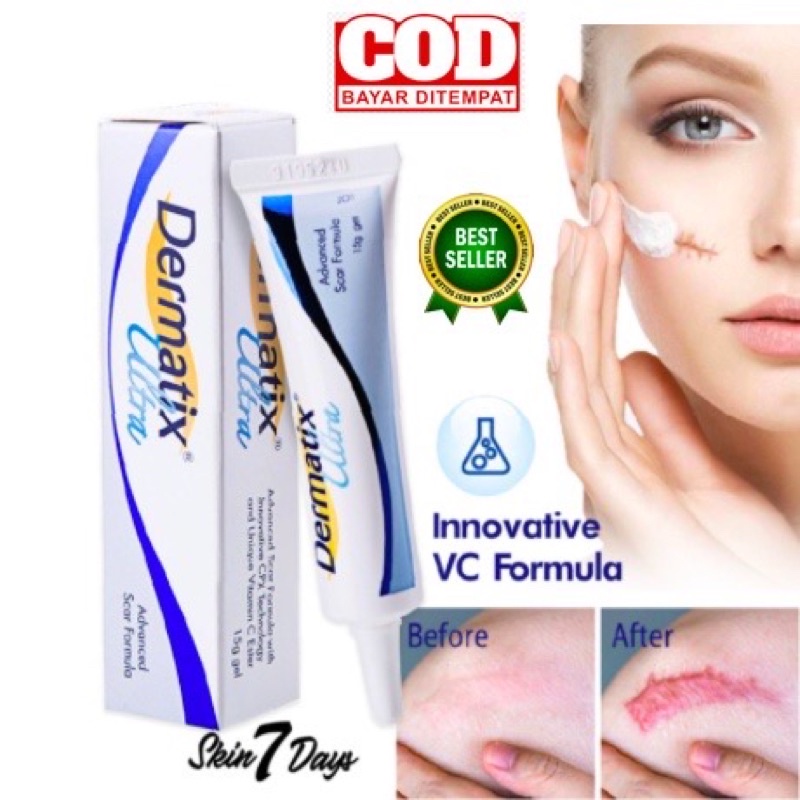 Jual Dermatix Ultra Obat Penghilang Bekas Luka Salep Bekas Luka 15 gr ...