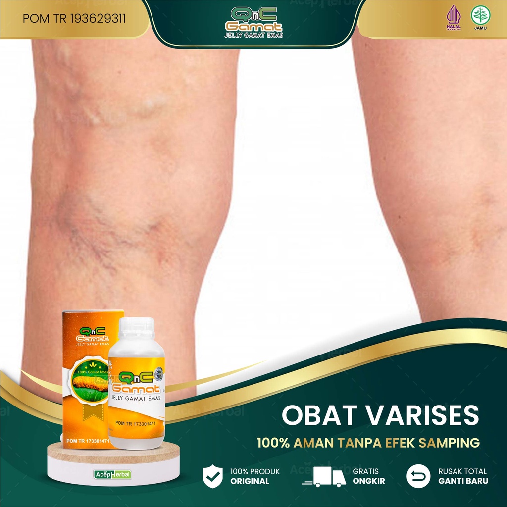 Jual Obat Varises Parah Dermatitis Statis Kaki Tungkai Betis Berat ...