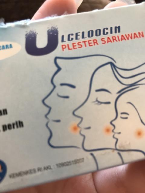 Halodent Dental Plester Sariawan Ulceloocin | Shopee Indonesia