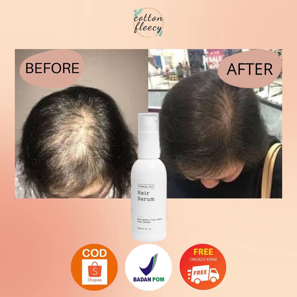 Jual FLEECY HAIR SERUM SOLUSI RAMBUT RONTOK (ON SALE) | Shopee Indonesia