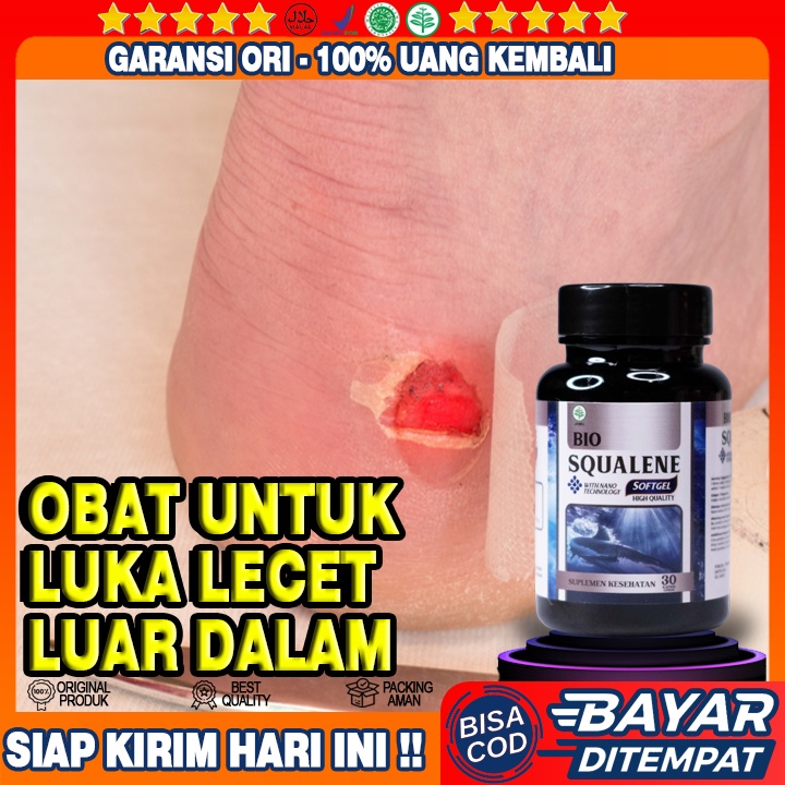 Jual Obat Luka Lecet Luar Dalam - Obat Luka Melepuh Kena Knalpot - Obat ...