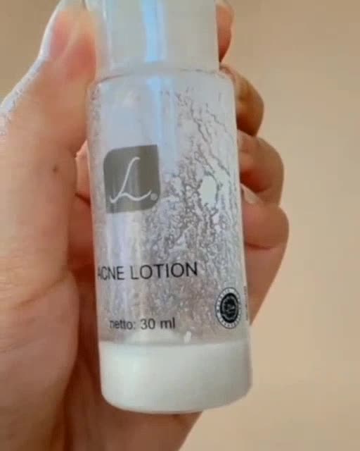 Jual Acne lotion larissa (obat jerawat) | Shopee Indonesia