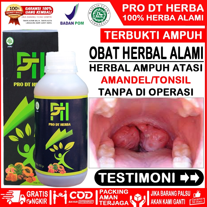 Jual Obat Amandel Herbal Original Paling Ampuh Untuk Anak Dan Dewasa Tanpa Operasi, Obat Tonsil ...