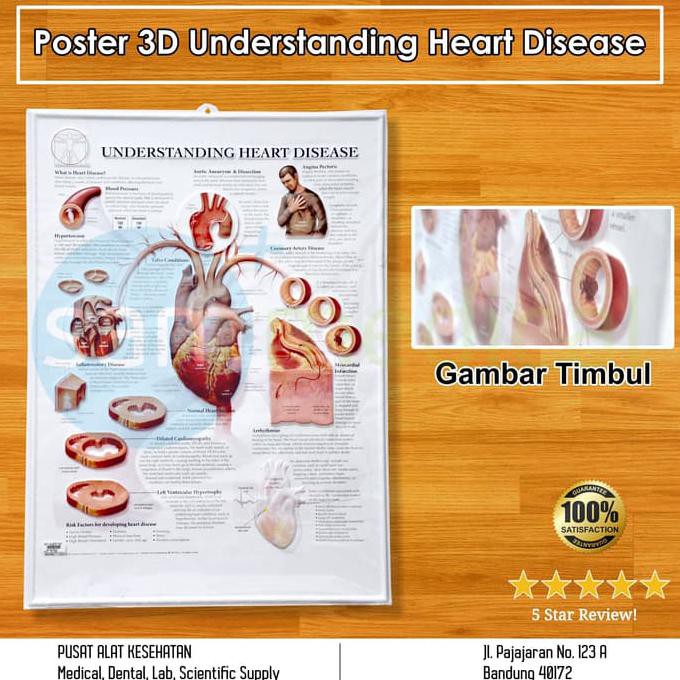 Jual POSTER PENYAKIT JANTUNG/POSTER 3D UNDERSTANDING HEART DISEASE BS ...