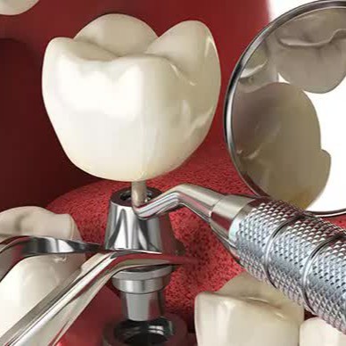 Produk project78 | Shopee Indonesia