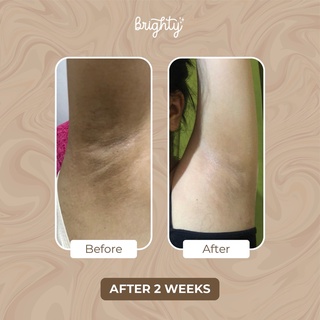 Jual BRIGHTY Glowing Underarm x Underarm Scrub (LIMITED PACKAGE ...