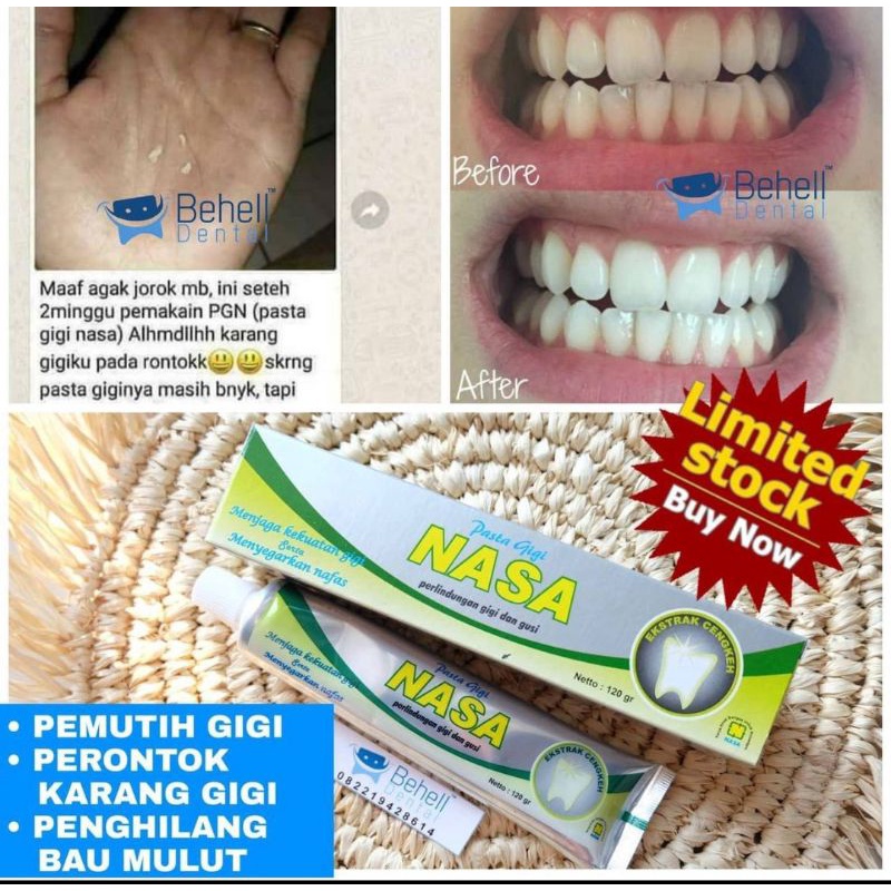 Jual PROMO ODOL / PASTA GIGI NASA HERBAL 100% ORI_ KEBUMEN Pemutih gigi ...