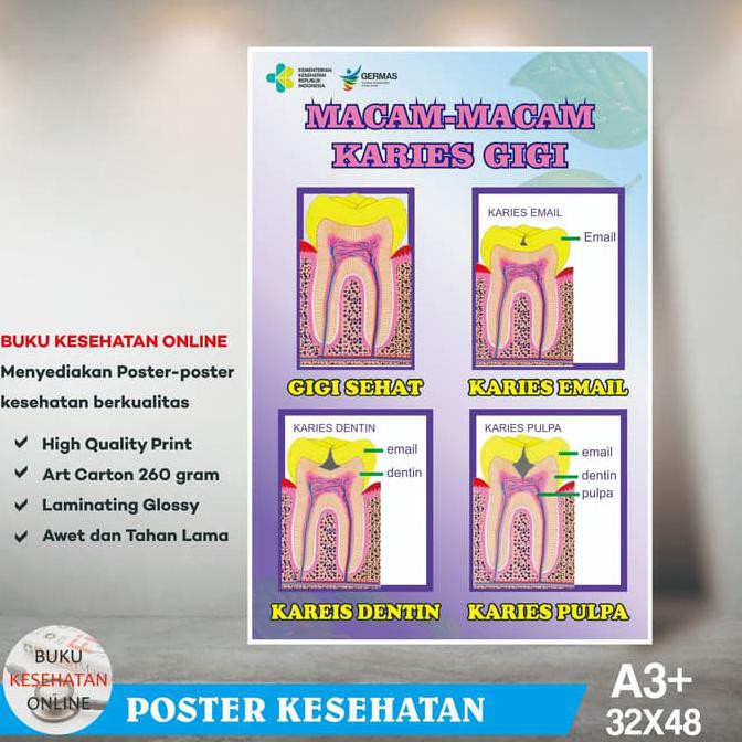 Jual Poster Kesehatan MACAM-MACAM KARIES GIGI - LAMINATING GLOSSY CUCI ...