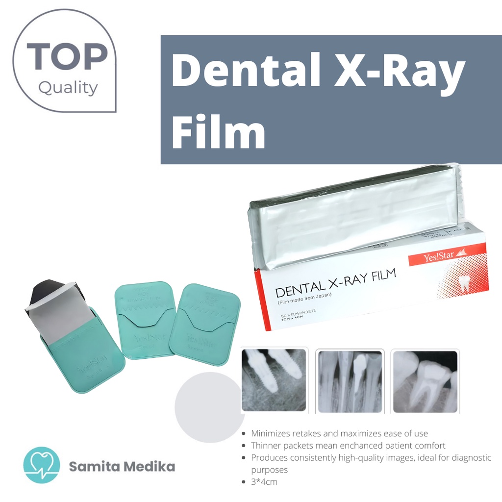 Jual dental x-ray /xray x ray film/rontgen periapical / foto periapikal ...