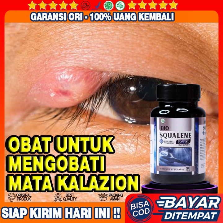 Jual Obat Kalazion Mata Bengkak Mata Bintitan - Benjolan Di Bawah Mata ...