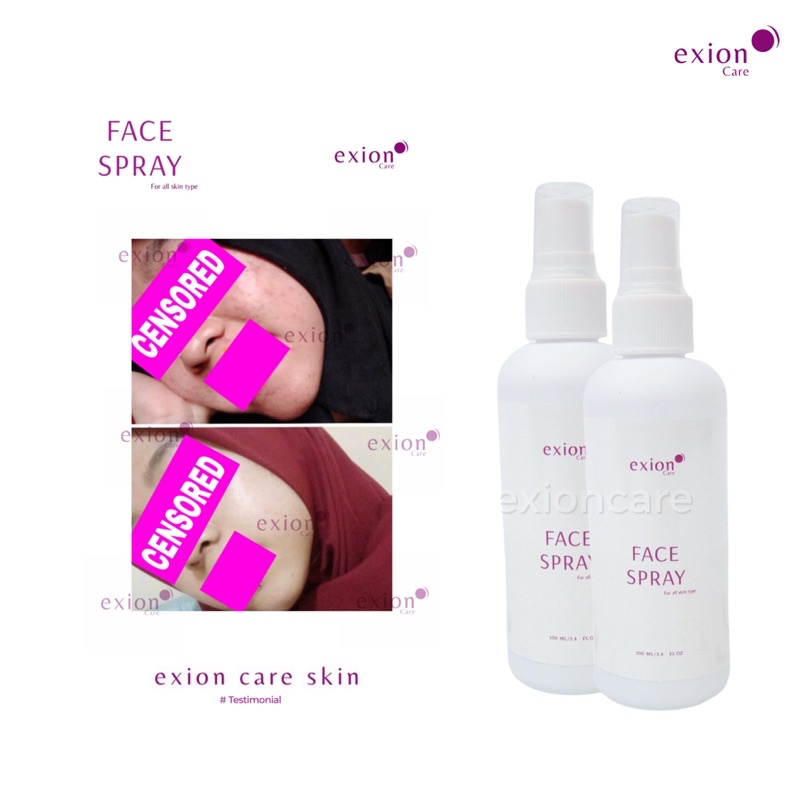 Harga Exioncare Terbaru Desember 2022 |BigGo Indonesia