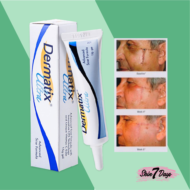 Dermatik Ultra / Dermatic / Dermatix Ultra Advanced Scar Formula Gel Cream Luka | Shopee Indonesia
