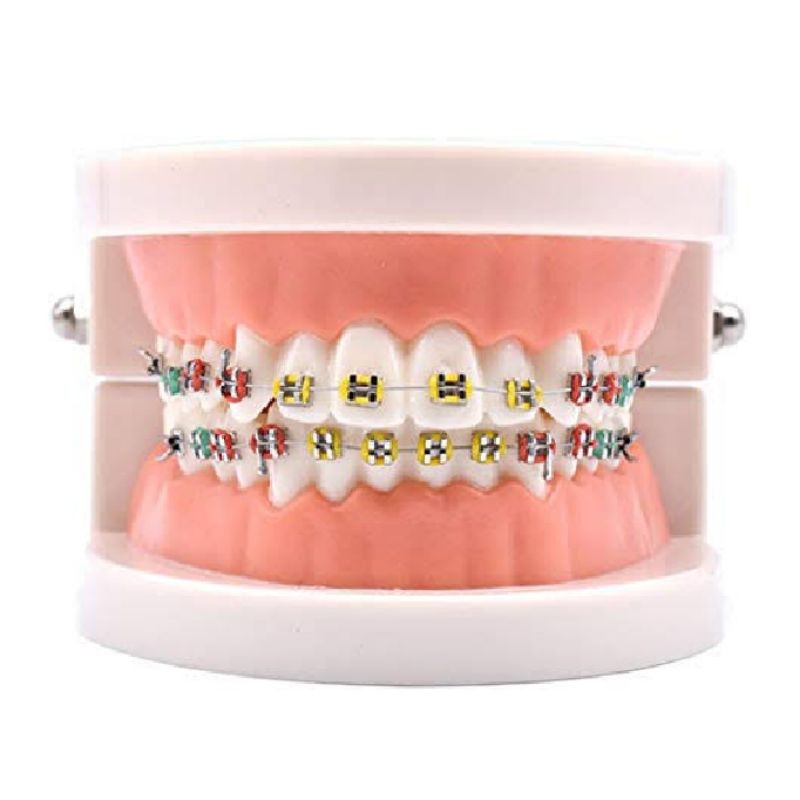 Dental Study Model Ortho - Phantom gigi - Pantom studi model bracket ...