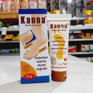 Jual [1BTL= 15GRAM] KANA KRIM / KANA WHITE CREAM / OBAT OLES KAKI ...