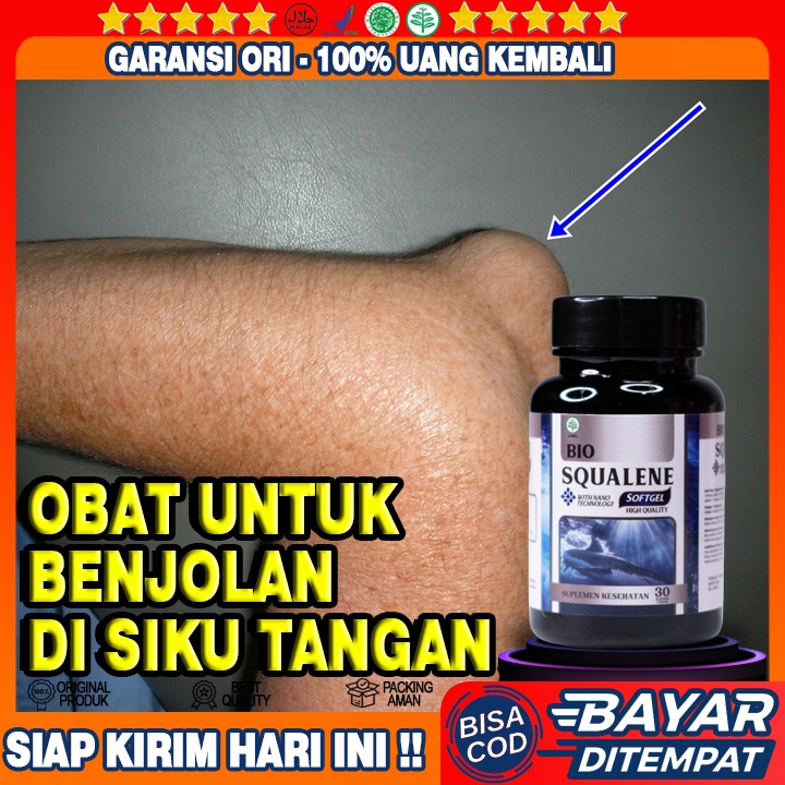 Jual Obat Benjolan Di Siku Tangan - Obat Alami Benjolan Tubuh ...