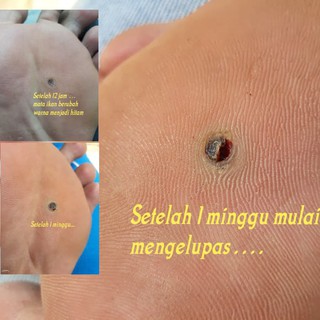 Obat Penyakit Mata Ikan Dalchaebi