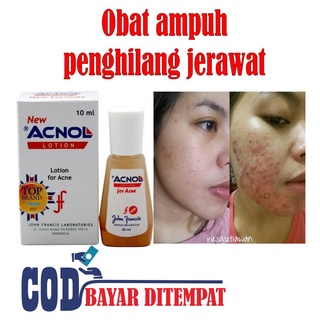 Jual Acnol Lotion obat jerawat 10ml / Acnol lotion for acne | Shopee ...