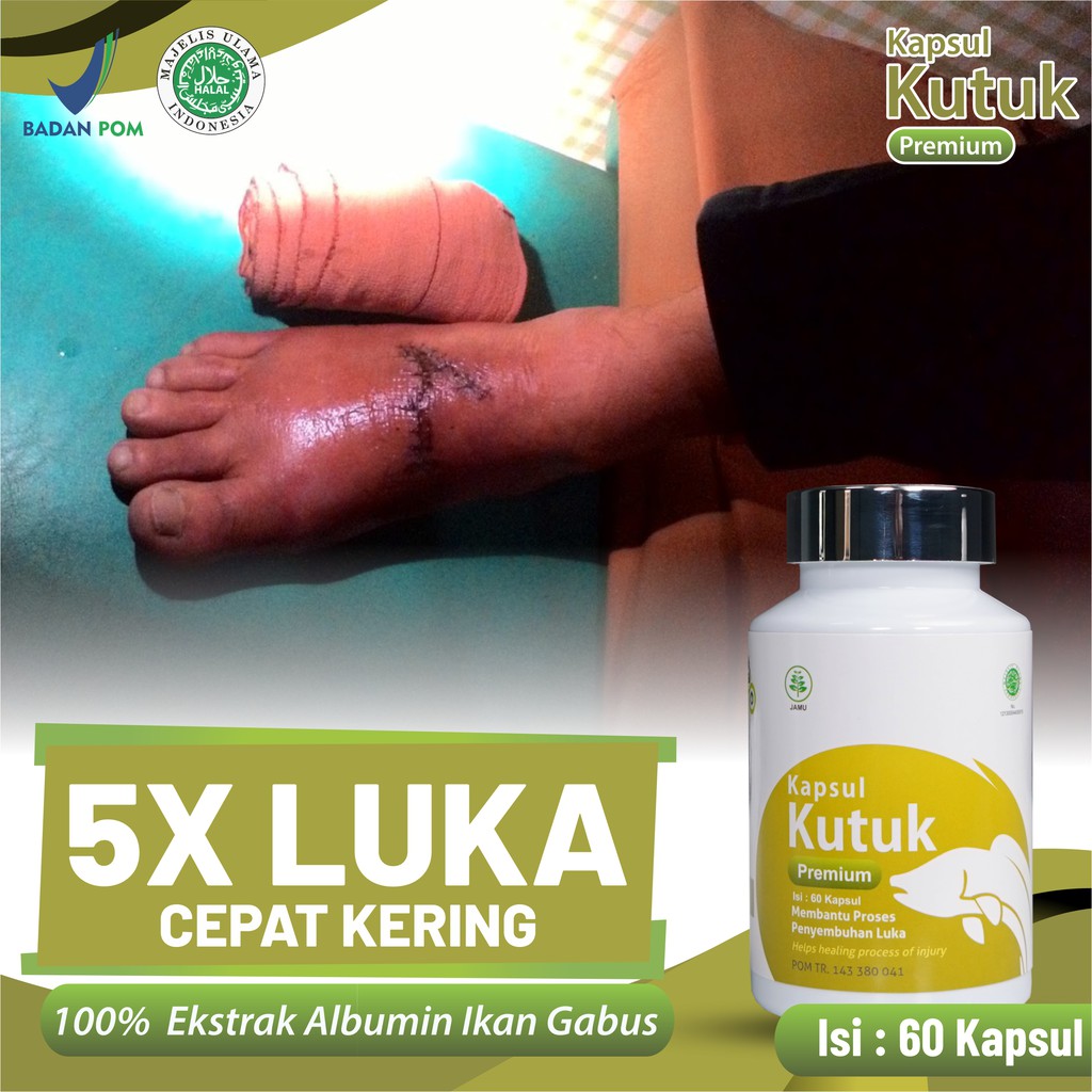 KAPSUL KUTUK PREMIUM EKSTRAK ALBUMIN IKAN GABUS OBAT LUKA PASCA OPERASI ...