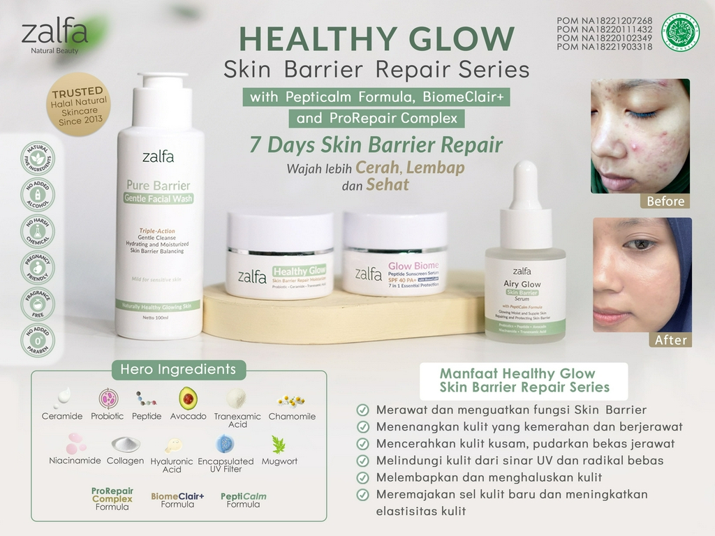 Toko Online Zalfa Natural Official Shop | Shopee Indonesia