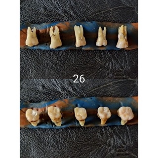 Jual Gigi Molar Atas | Shopee Indonesia