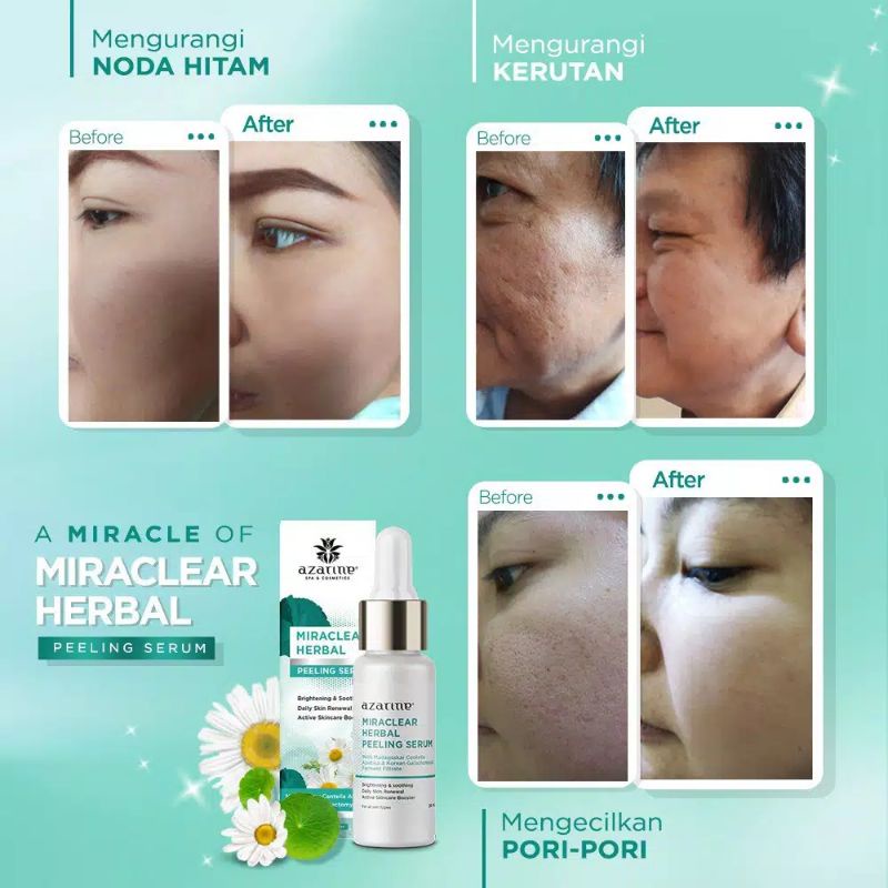 Jual Azarine Miraclear Herbal Peeling Serum AHA BHA 20ml | Shopee Indonesia