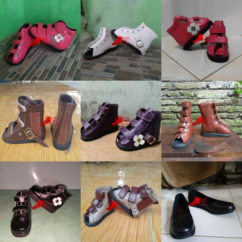 Jual Sepatu Ortopedi untuk Koreksi Flat Foot / Kaki Datar / Latihan ...