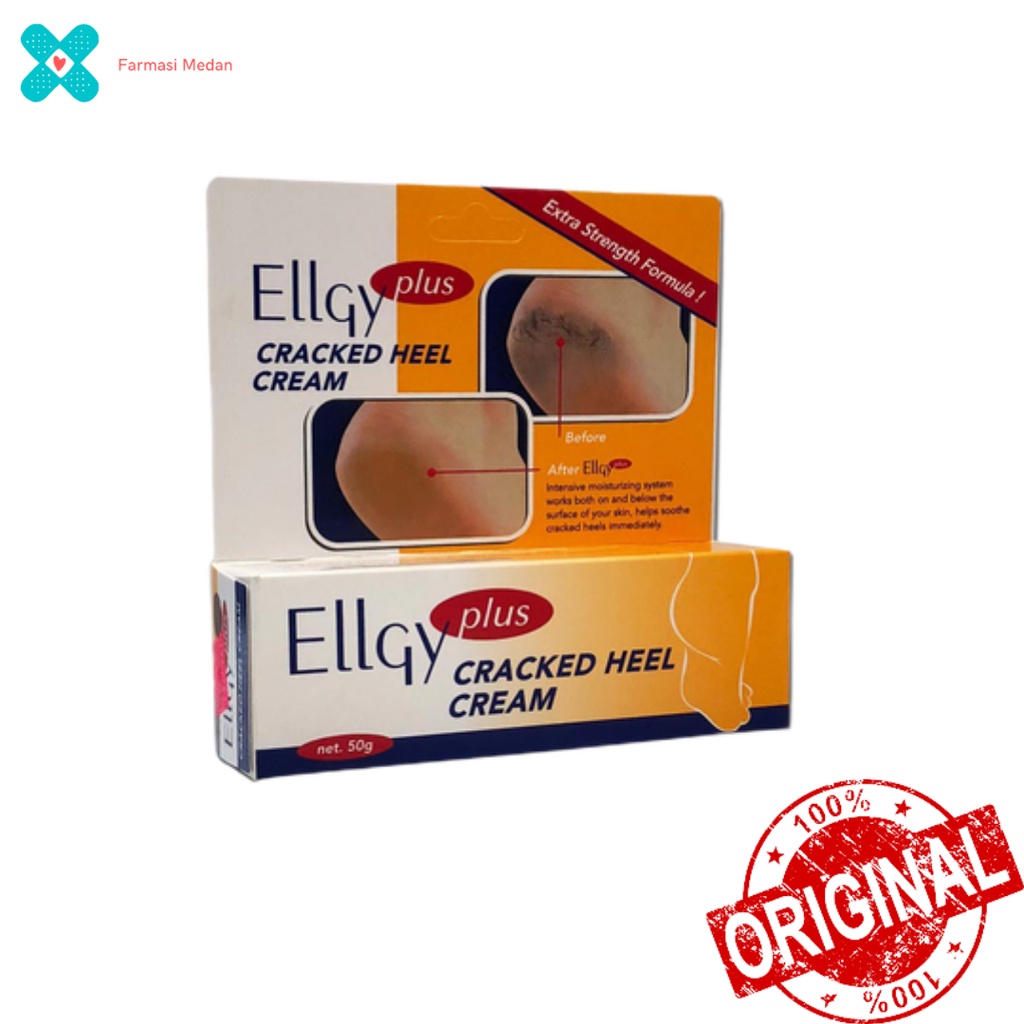 Jual Ellgy Plus Cracked Heel Cream 50g | Shopee Indonesia