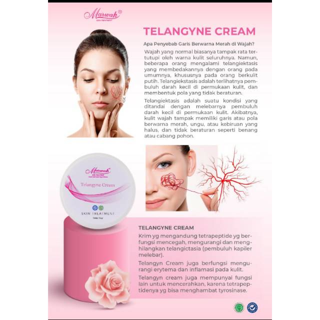 Jual MARWAH TELAGYN CREAM || TELAGYN CREAM || URAT URAT MERAH DI WAJAH ...