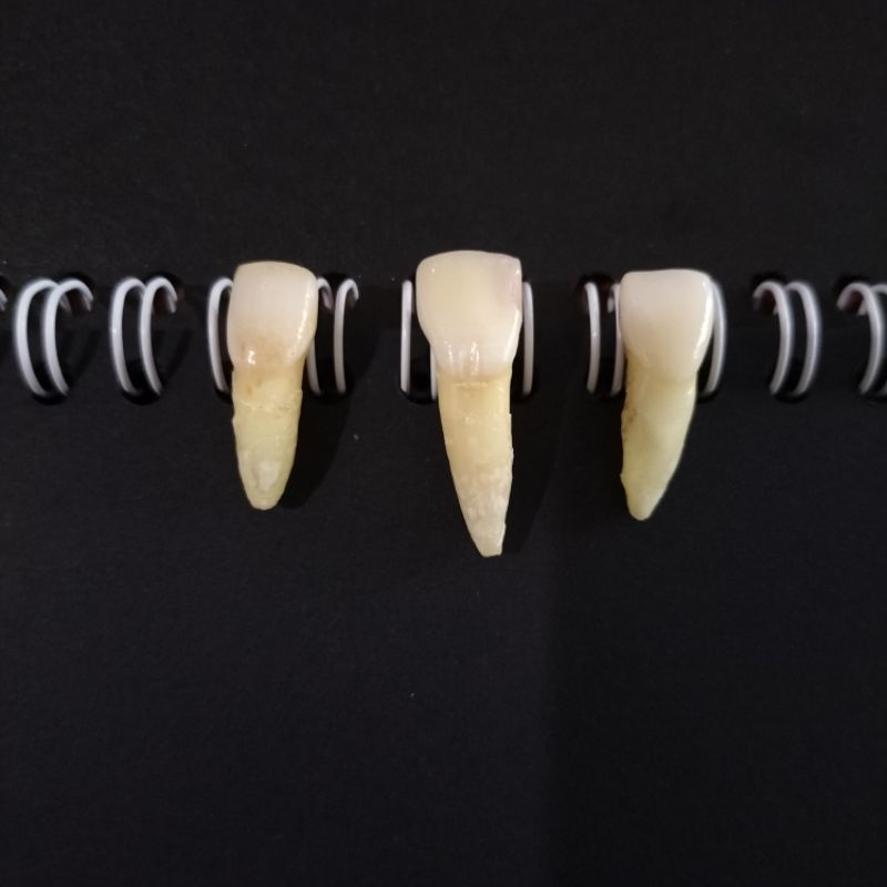 Jual Gigi Insisivus Centralis Manusia Asli / Gigi Insisivus Pertama ...