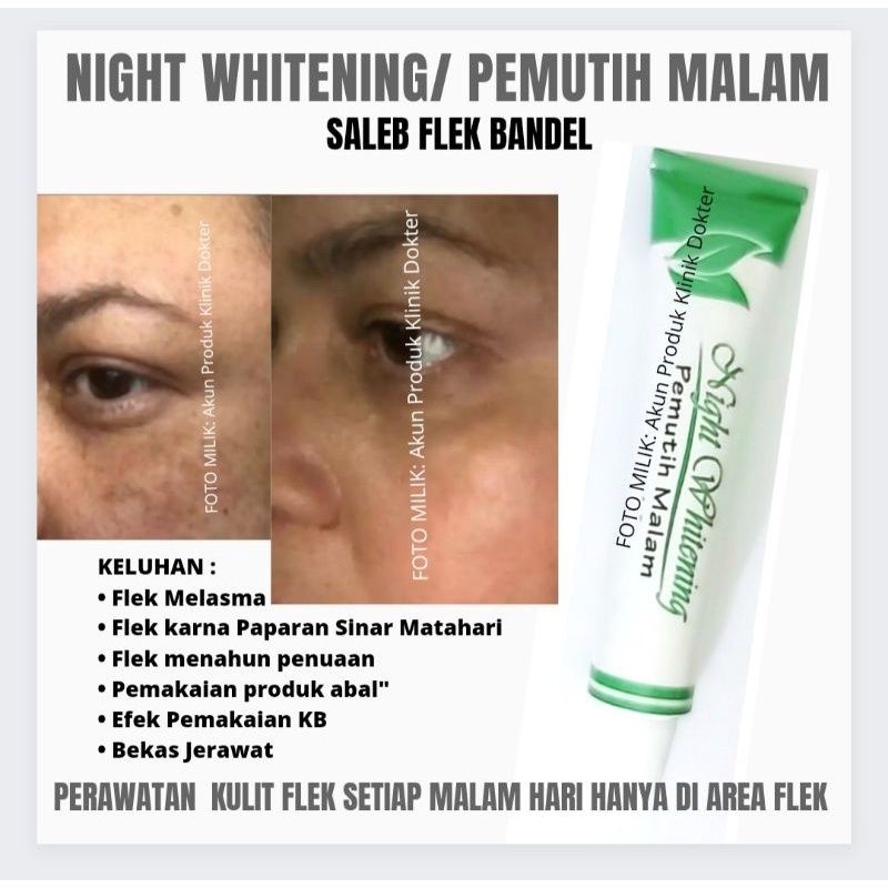 Jual Salep Flek Racikan Dokter Liz | Shopee Indonesia