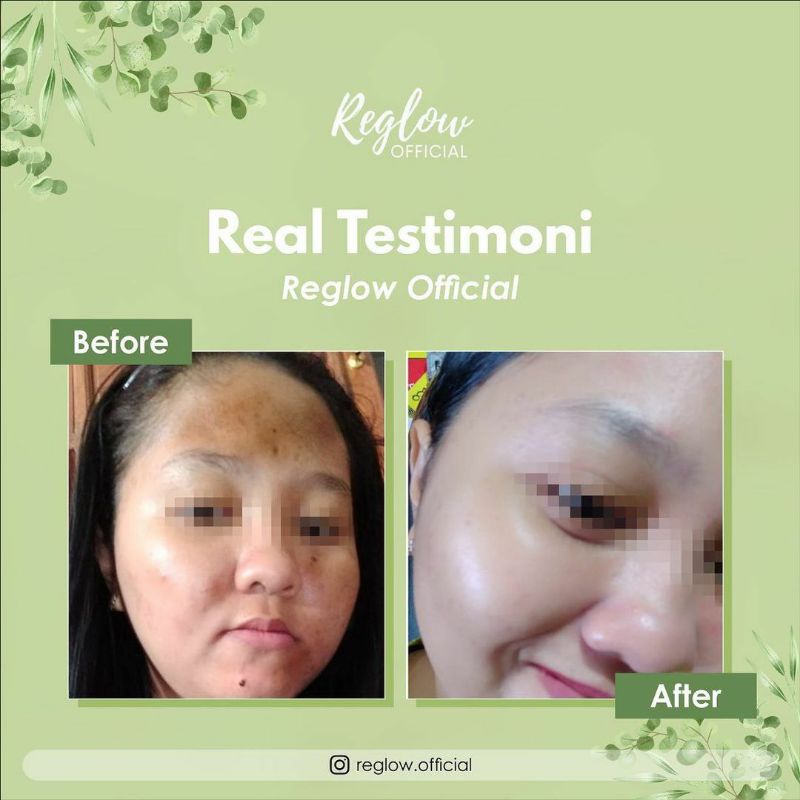 Jual REGLOW skincare MENGATASI MILIA JERAWAT FLEK HITAM KUSAM DLL ...