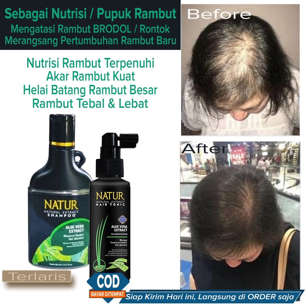 Jual Paket Penumbuh Penyubur Rambut AMPUH Cegah Rontok Penguat Akar ...