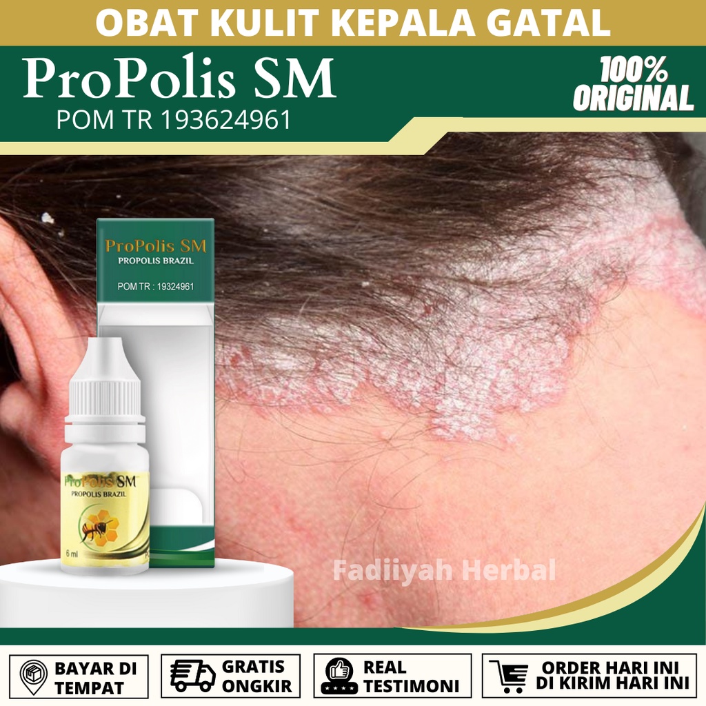 Jual Obat Kulit Kepala Gatal, Obat Kulit Kepala Berjamur, Obat Kulit Kepala Berkerak, Obat Kulit ...